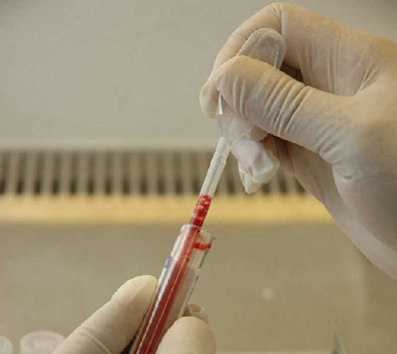 New DNA testing technique for blood transfusion safety - Oman Observer