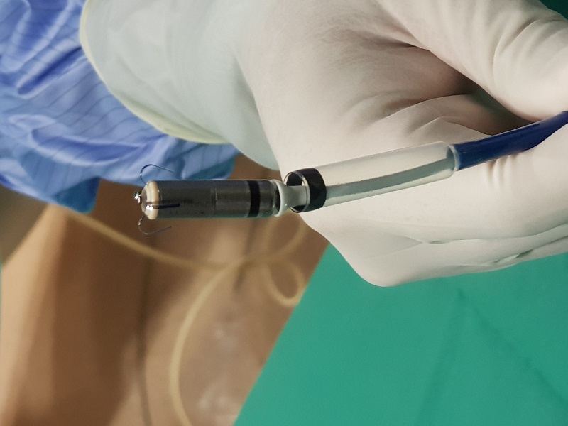 Implant of world’s smallest Pacemaker in Oman - Oman Observer